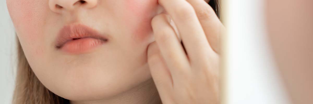 Sensitive Skin – Signs, Causes and How to Manage It – AMPERNA®